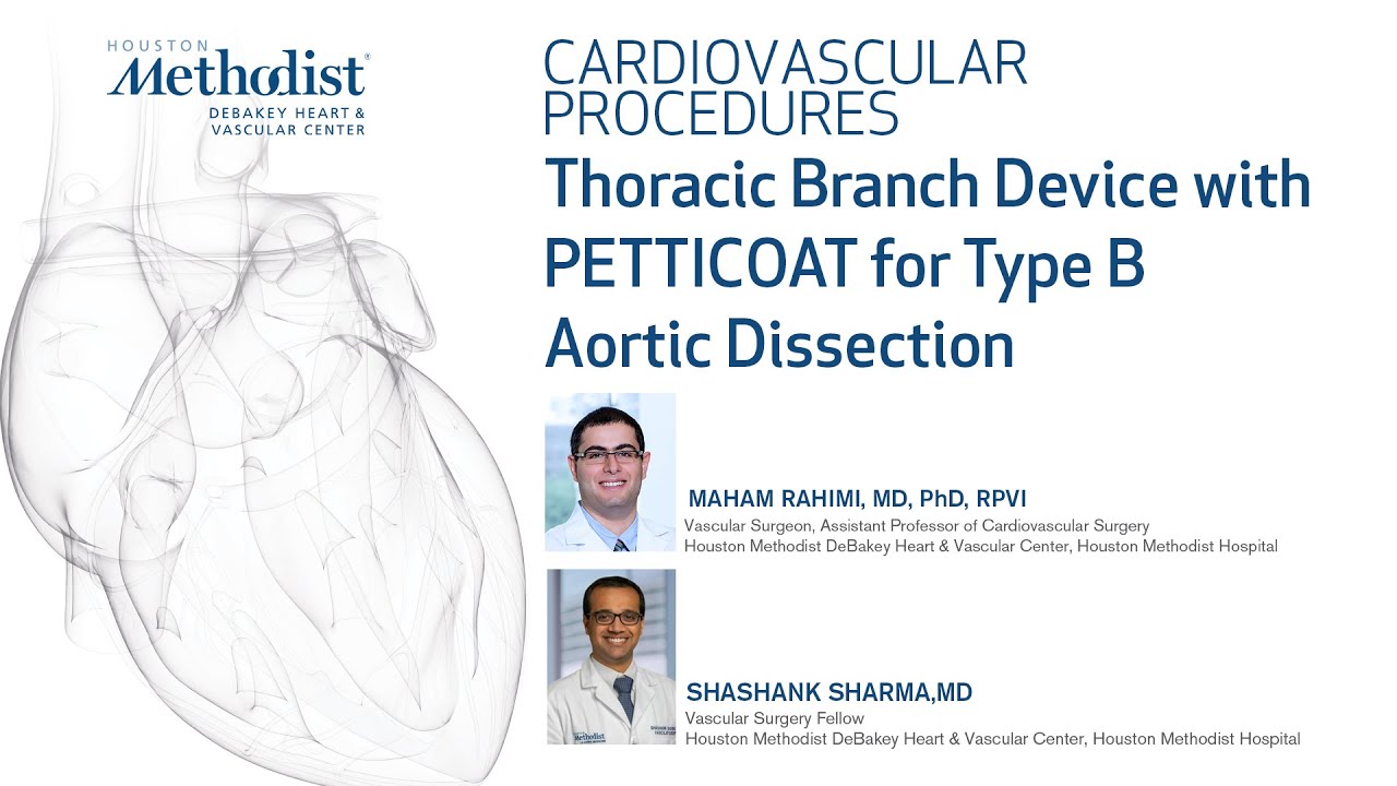 Thoracic Branch Device with PETTICOAT for Type B Aortic Dissection ...