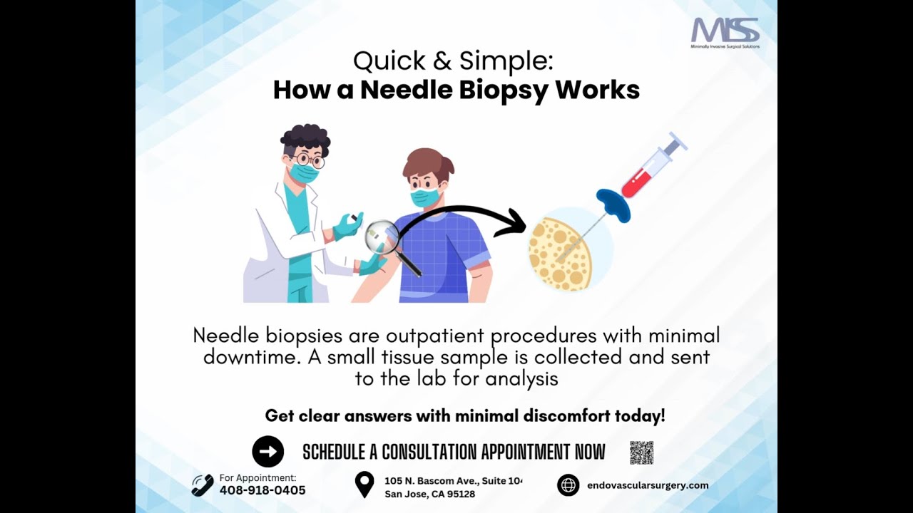 Quick & Simple: How a Needle Biopsy Works? - YouTube