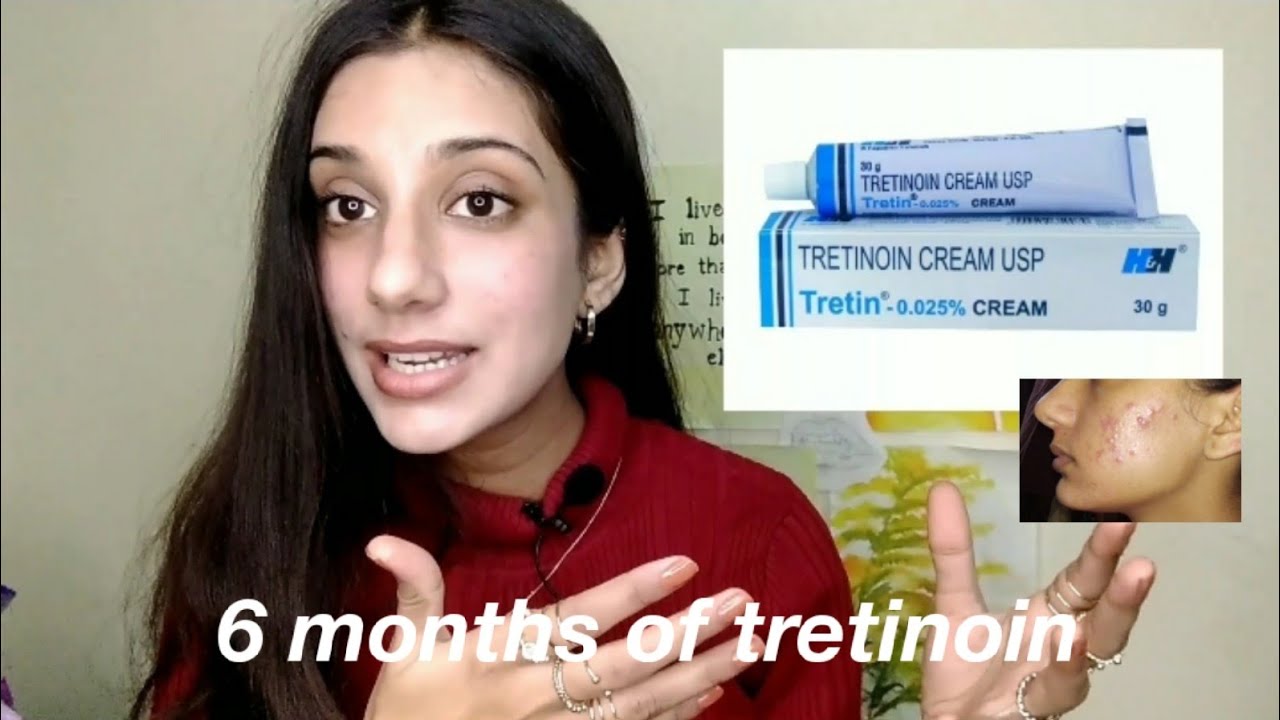 Tretinoin for beginners | Usage, side effects, purge and results | My ...