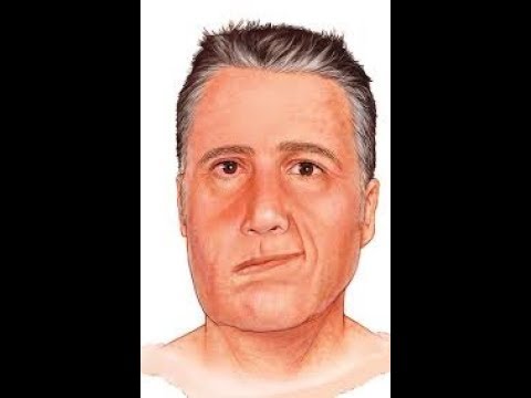 Bell's palsy DR SAMEH GHAZY - YouTube