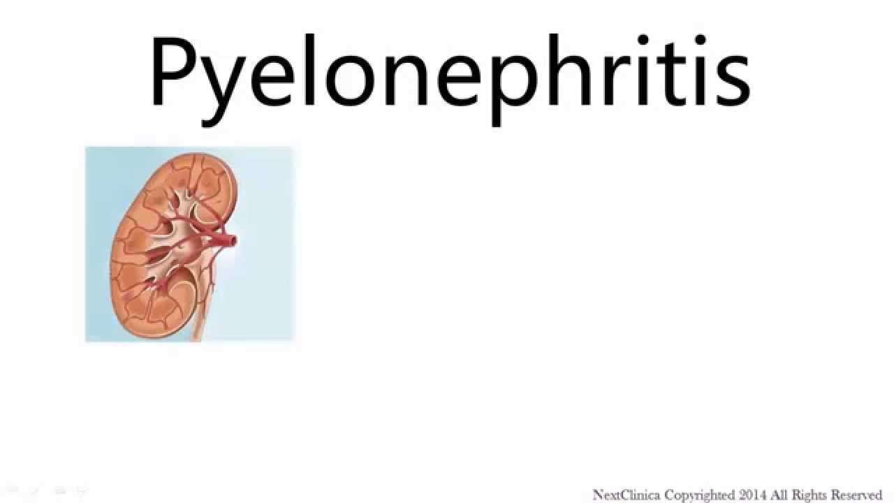 Pyelonephritis - YouTube