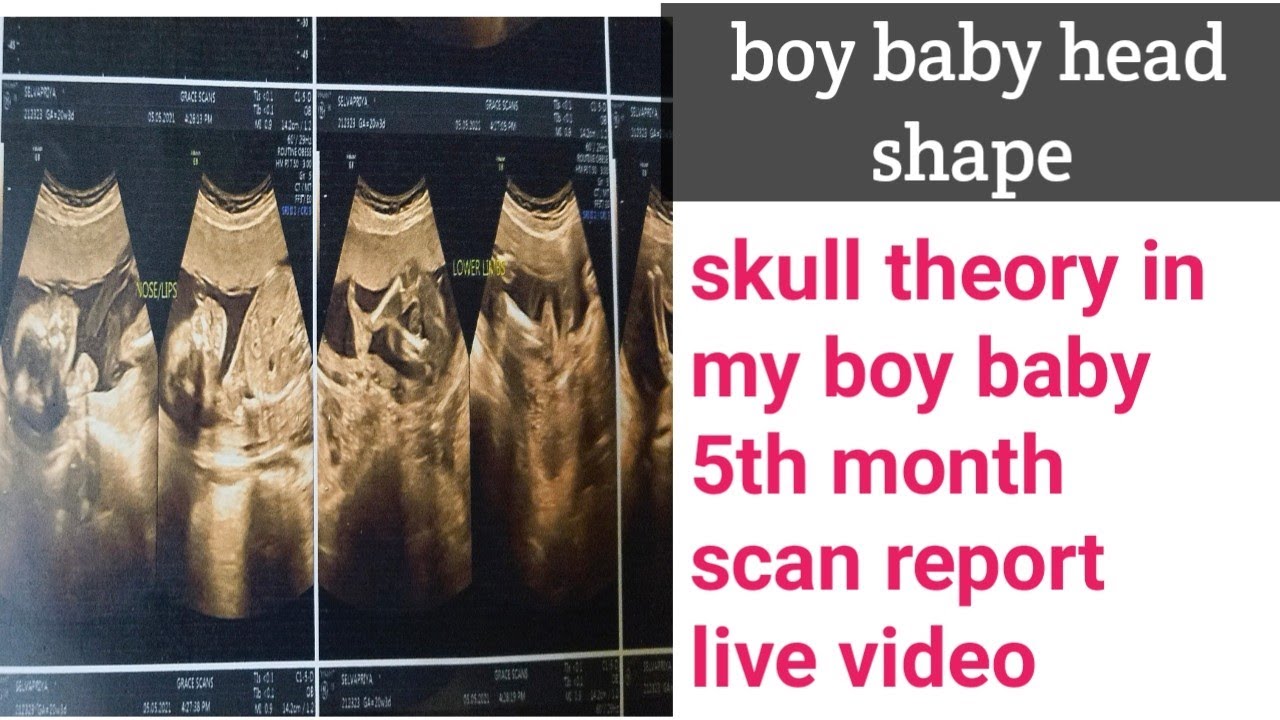 skull theory 5th month boy baby anomaly scan live video head shape easy ...