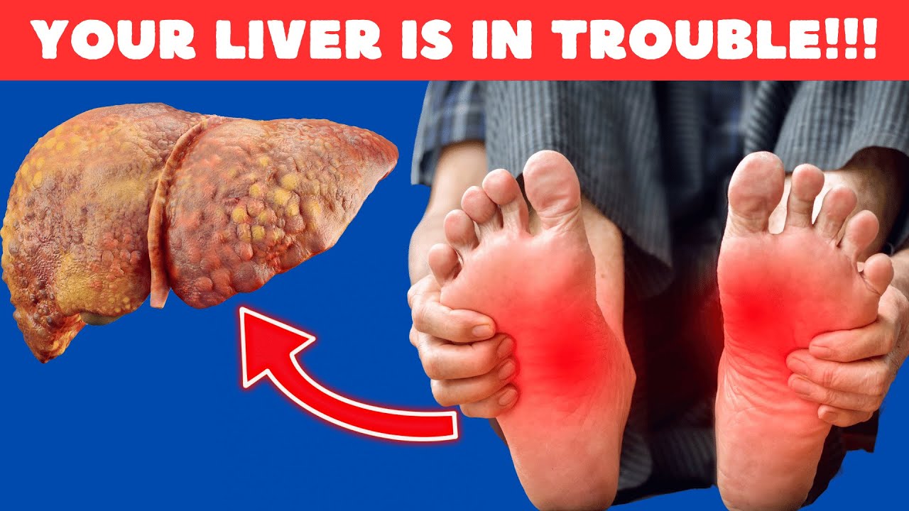 Must Watch: 7 Signs Your Feet Are Telling You That Your Liver Is In ...