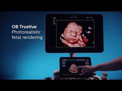 The all new Philips EPIQ ELITE