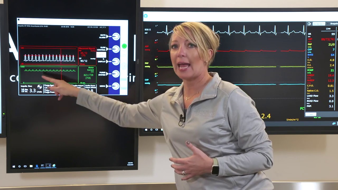What the Automated Impella Controller (AIC) is Displaying - YouTube