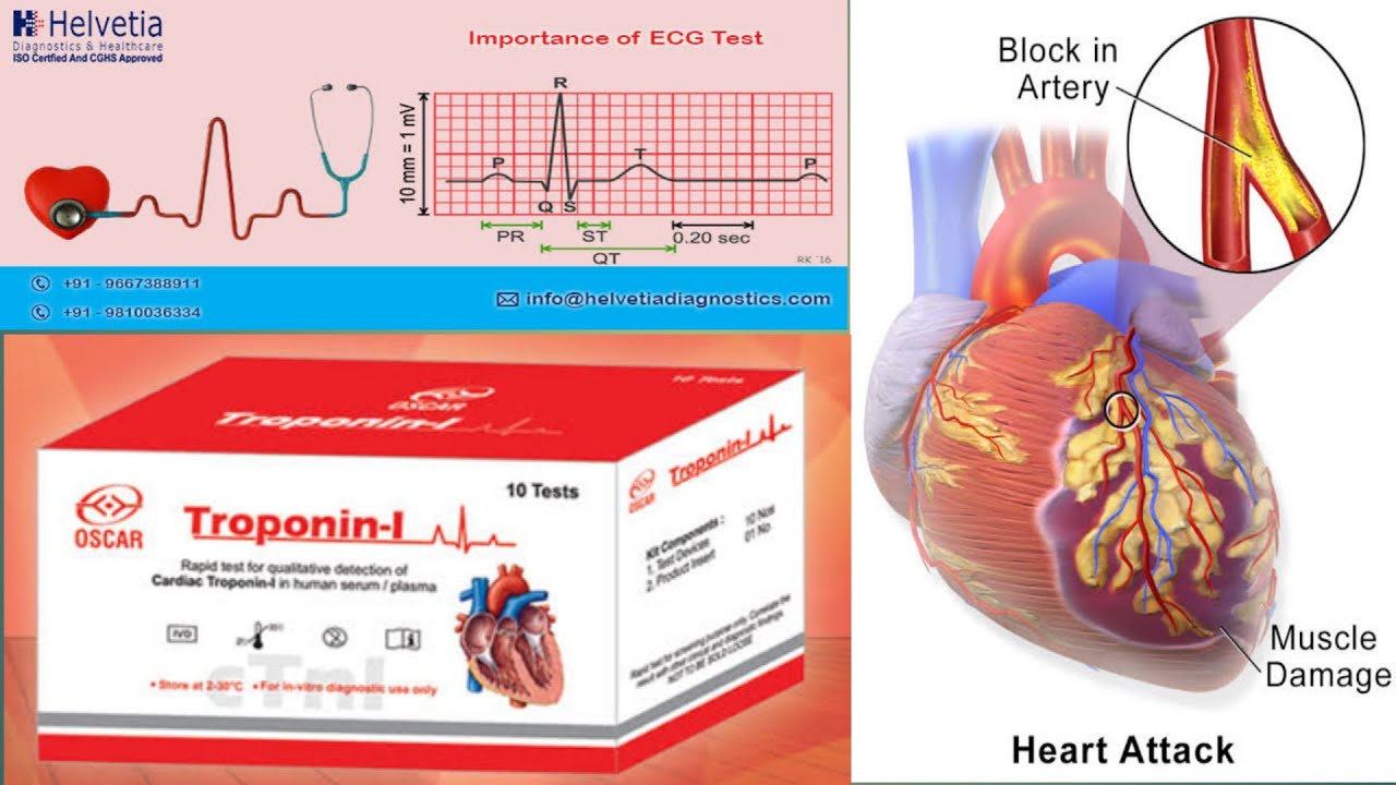 Troponin I test procedure/Trop I for Heart test/Troponin I test in ...