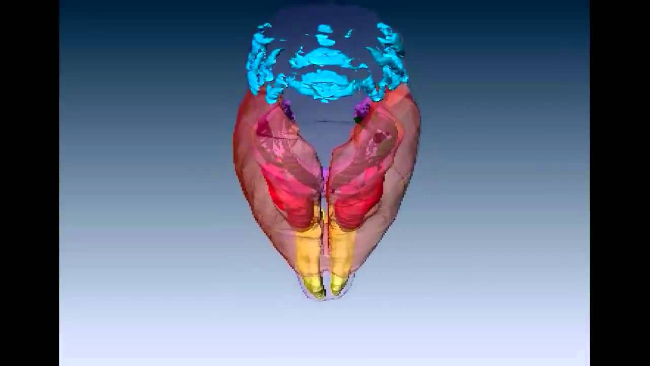3D brain reconstruction & surface rendering (Partial reconstruction ...