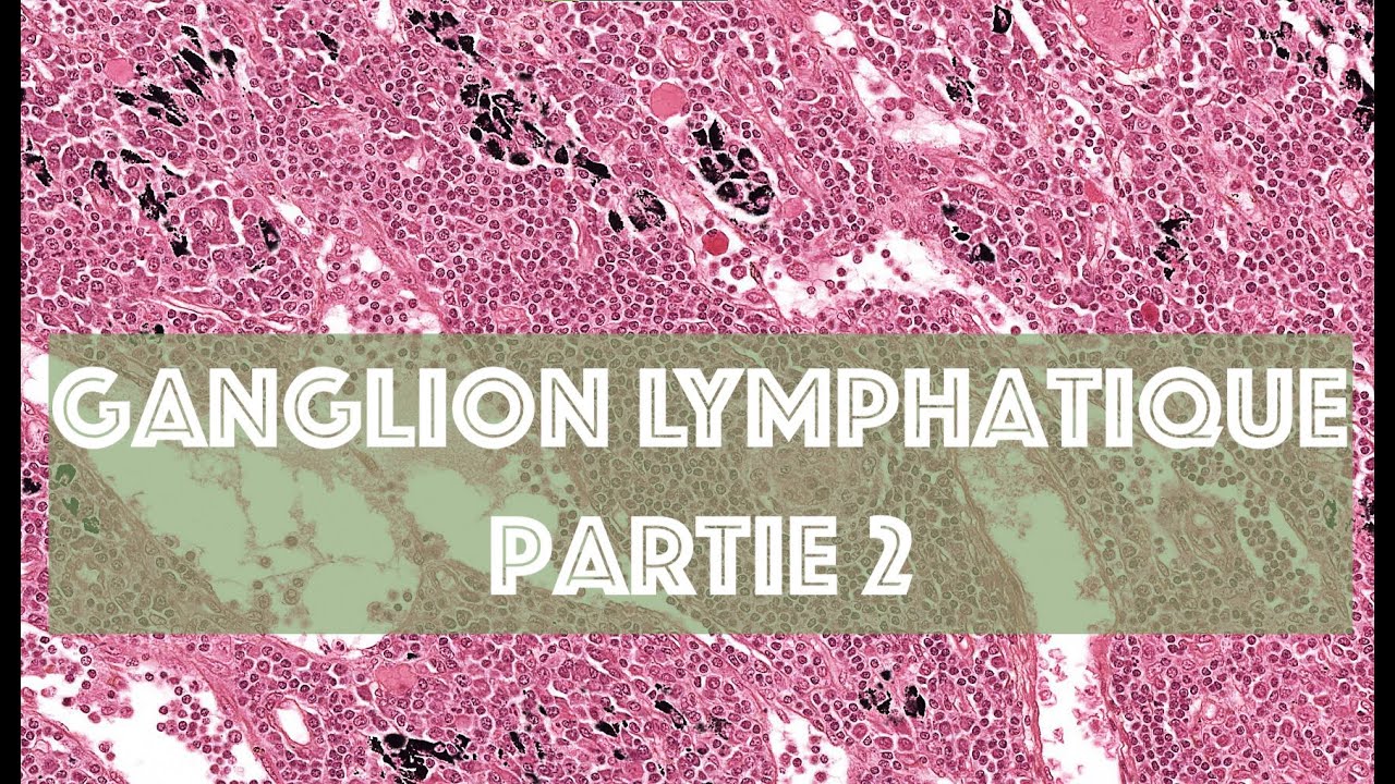LE GANGLION LYMPHATIQUE (partie 2) - HISTOLOGIE - YouTube