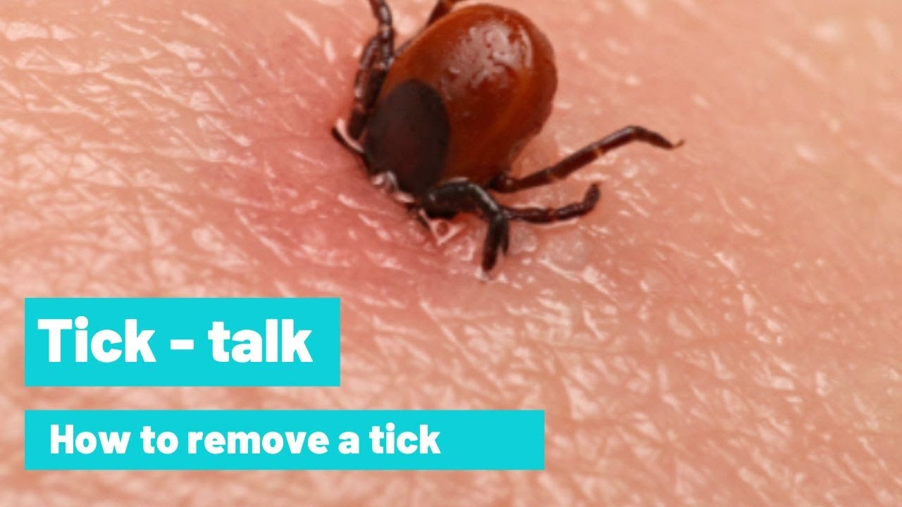 Tick - talk . How to remove a tick - YouTube