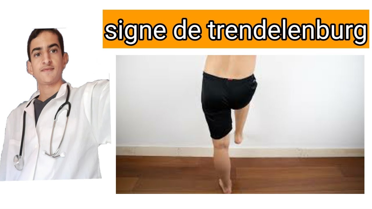 signe de Trendelenburg - YouTube