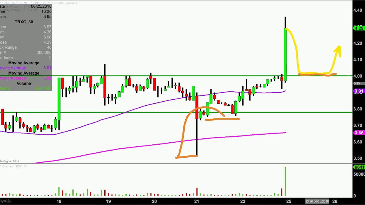 TransEnterix, Inc. - TRXC Stock Chart Technical Analysis for 06-22-18 ...