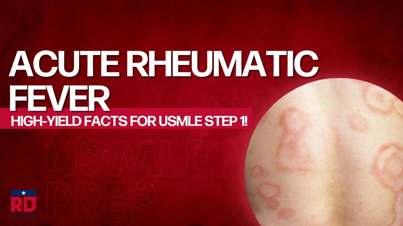 Acute Rheumatic Fever YouTube: High-Yield Facts for USMLE Step 1! - YouTube