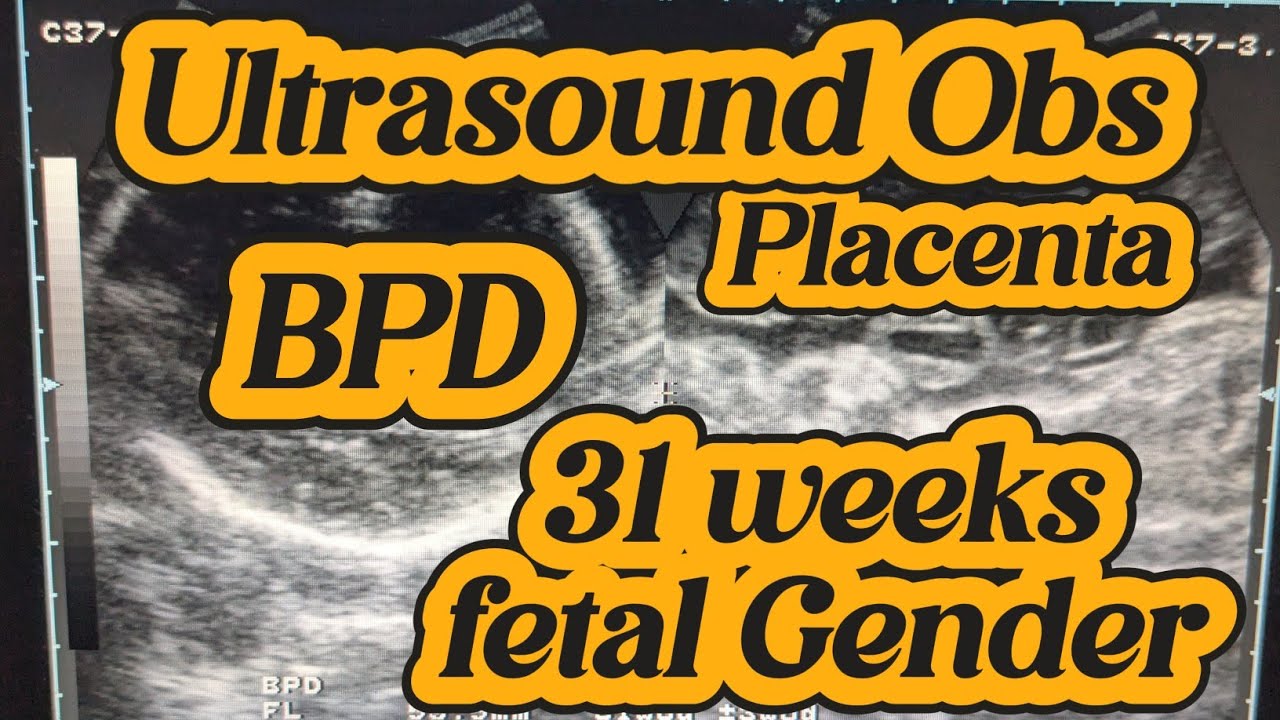 31 weeks Pregnancy | Third Trimester | Gyne Obs Scan | Male Baby ...