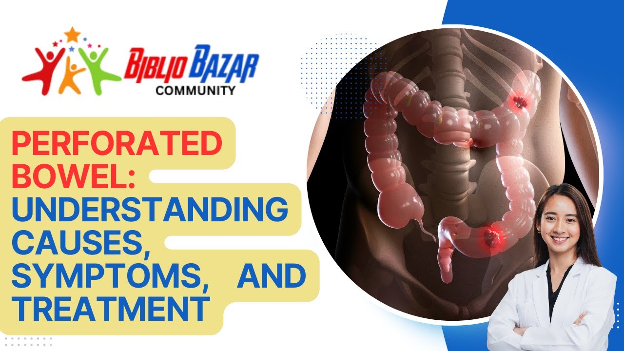 🩺 Understanding Perforated Bowel: Causes, Symptoms, and Treatment ...