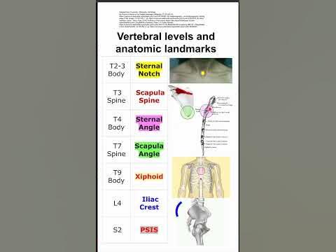 Vertebral levels and anatomic landmarks - YouTube