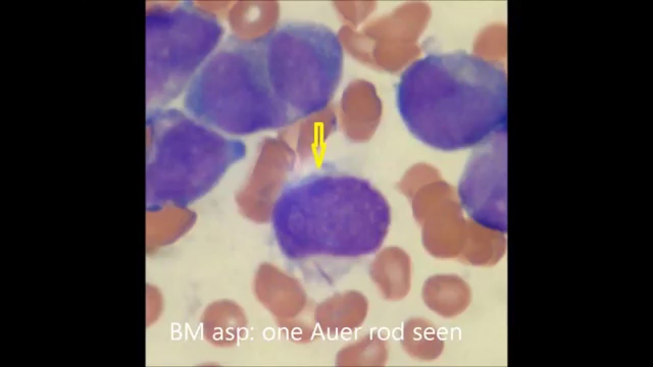 Auer rods in fagot - YouTube