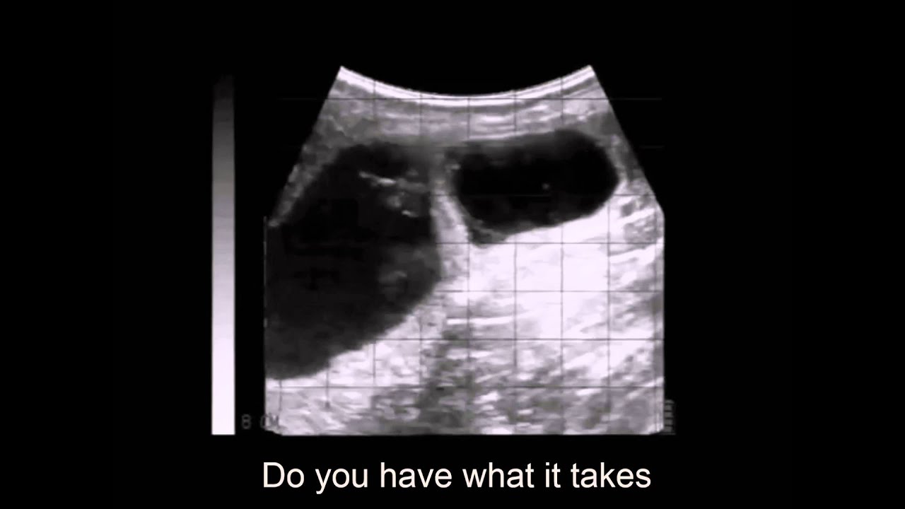 BCF Easi-Scan Curve ultrasound aging quiz - YouTube