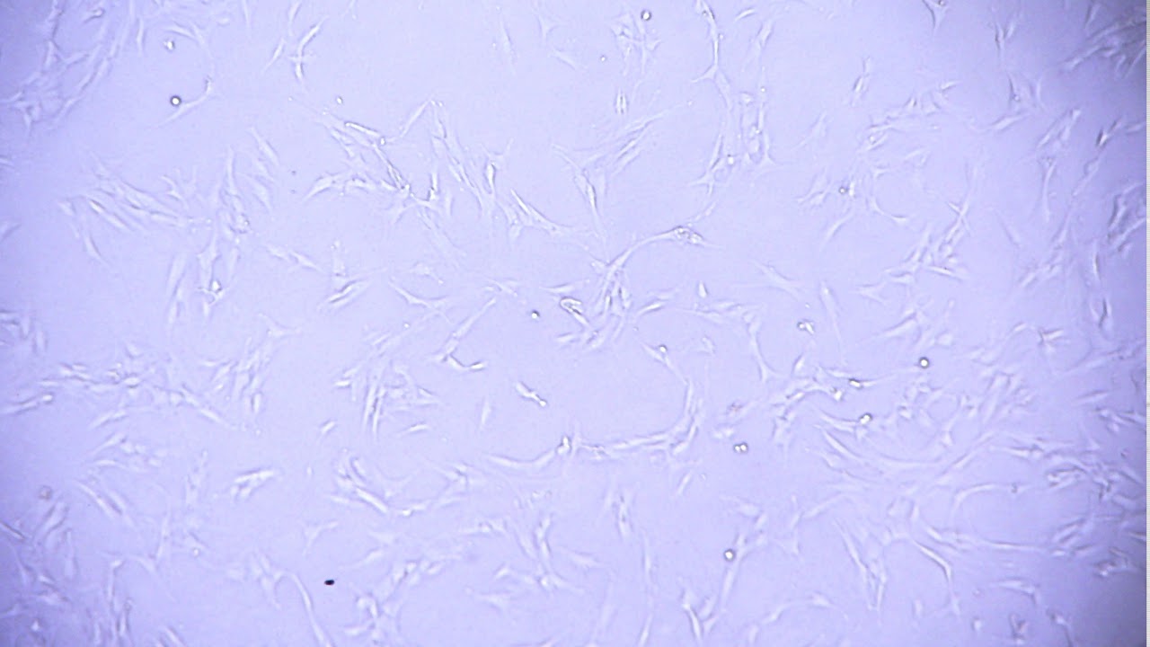 48h Live Cell imaging with my self-built live cell imaging microscope ...