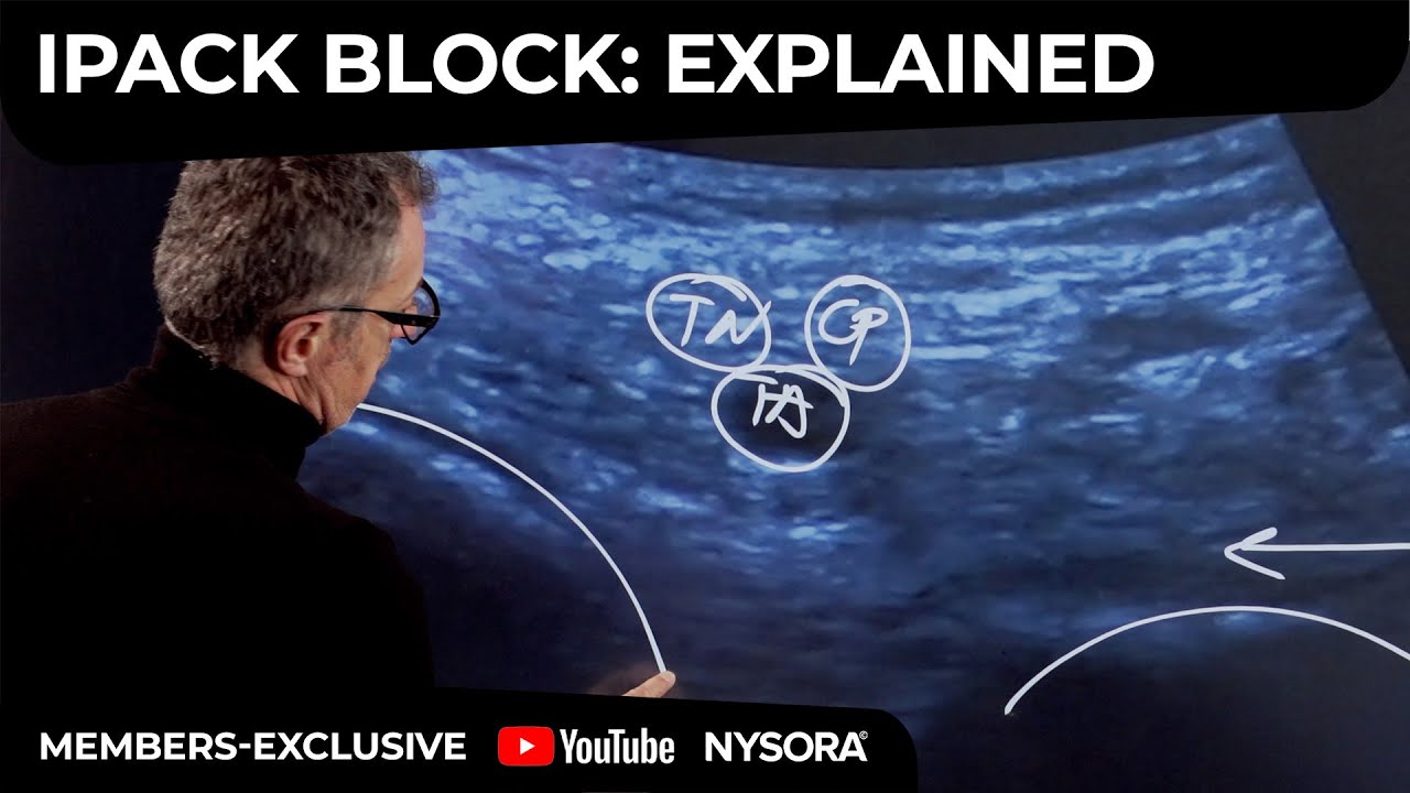 IPACK Block: Explained - Crash course with Dr. Hadzic - YouTube