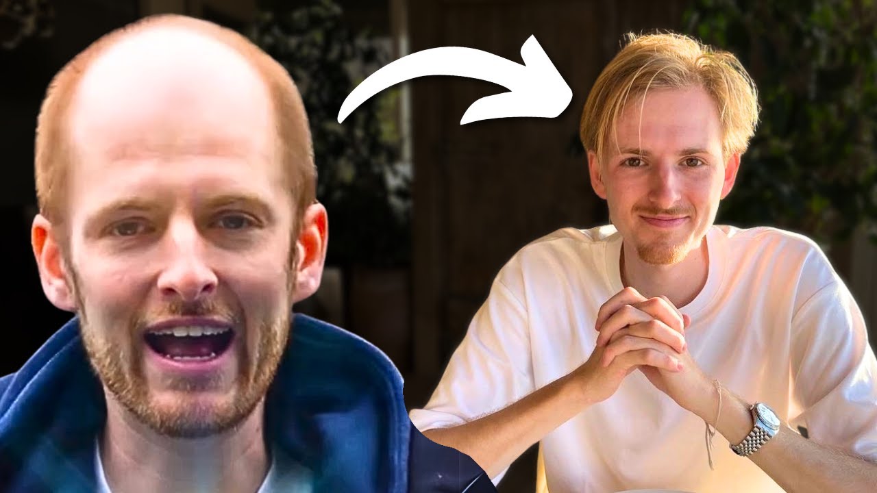 Hierom ging Koen (Bankzitters) écht Kaal.. 😬 - YouTube