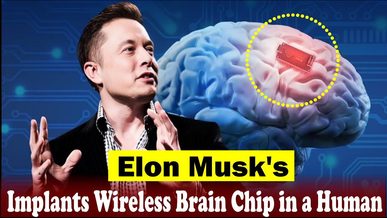 Elon Musk Brain Chip | Elon Musk Neuralink First Human Trial | Elon ...