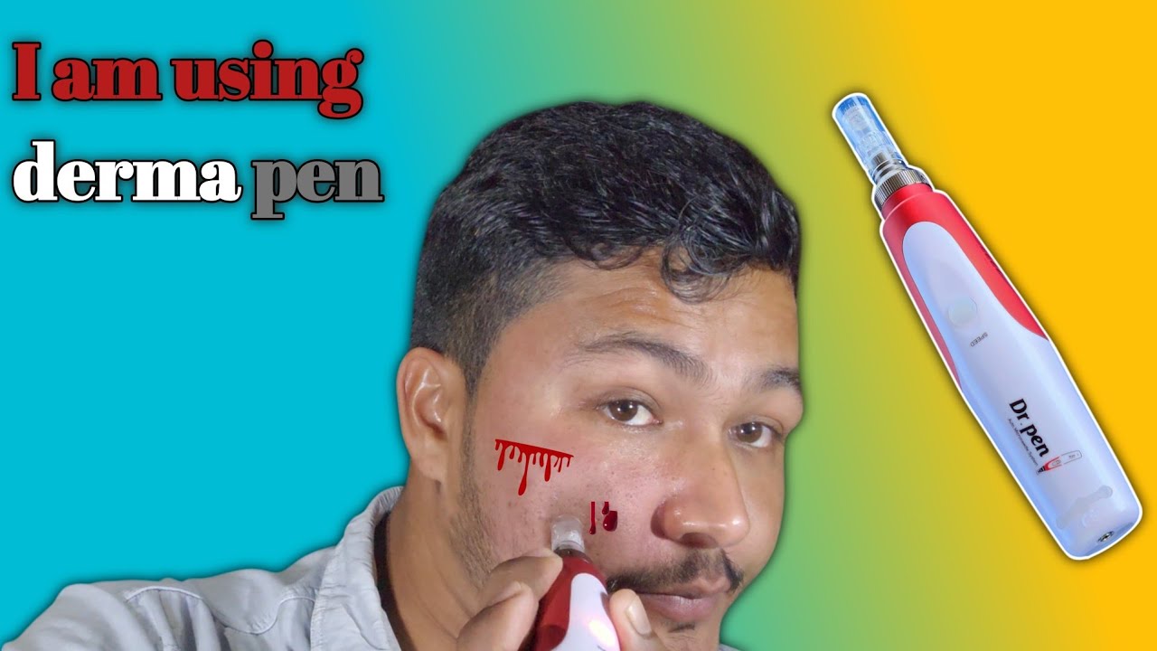 I am using derma pen Watch this video - YouTube