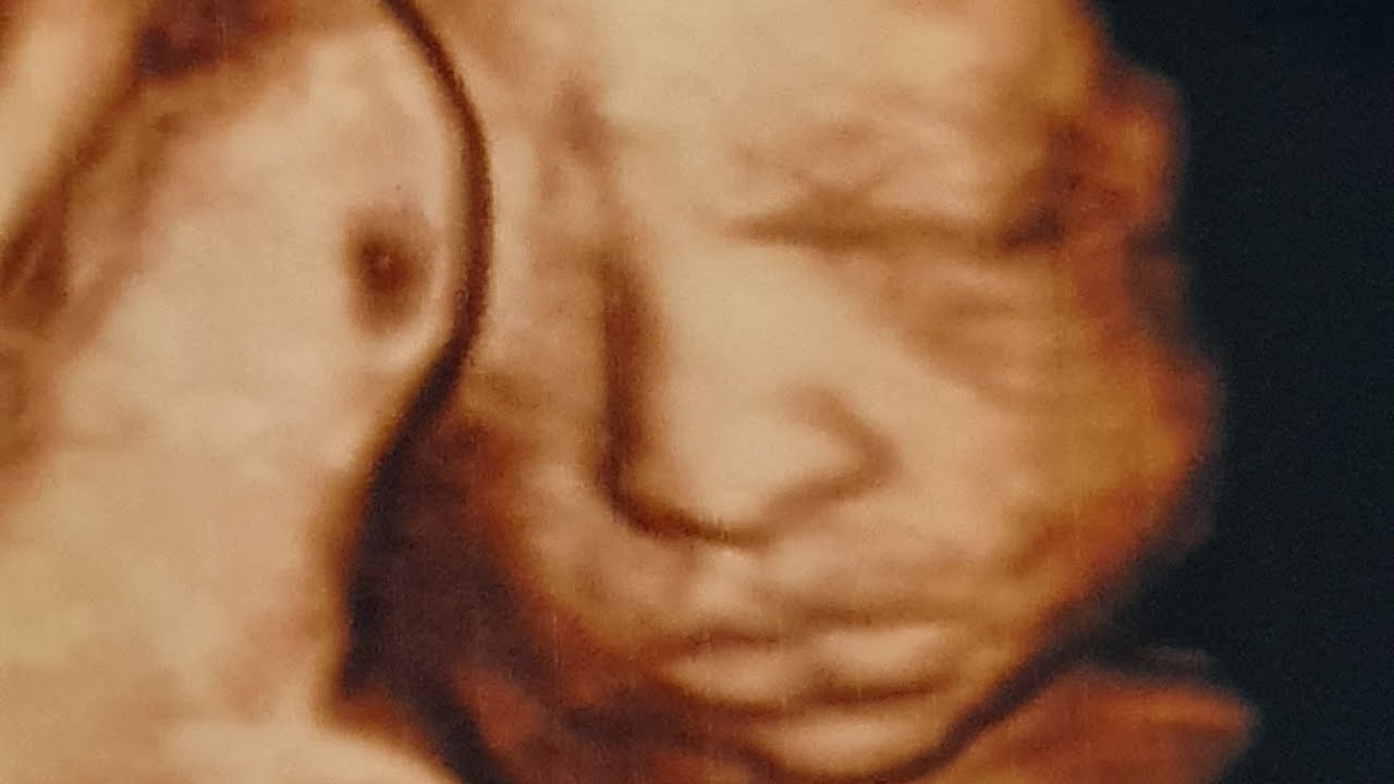 Vimos a NUESTRA BEBÉ en 4D!!😍 - YouTube