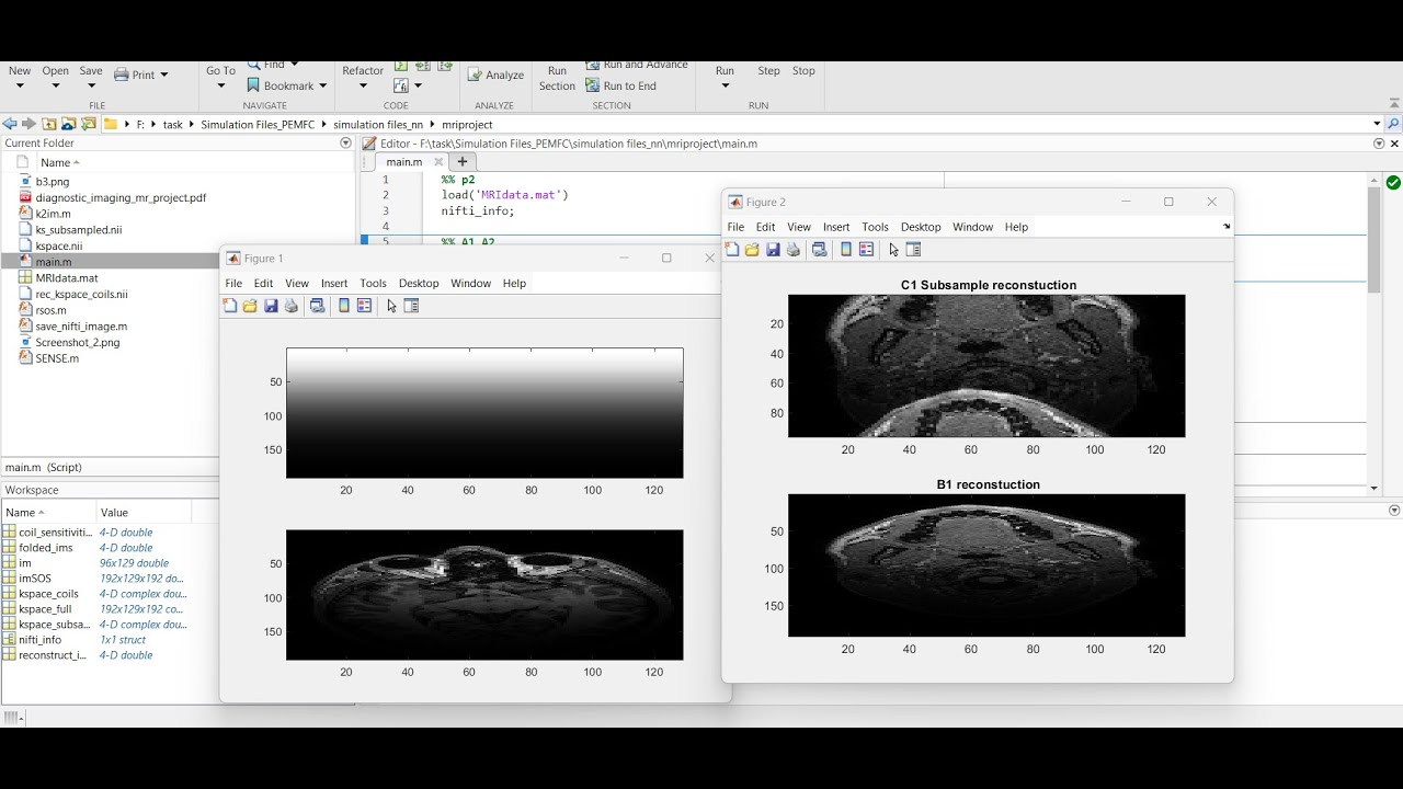 Image Reconstruction for Magnetic Resonance Imaging (MRI) using MATLAB ...