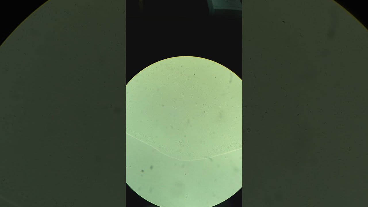 Hanging Drop Test - YouTube