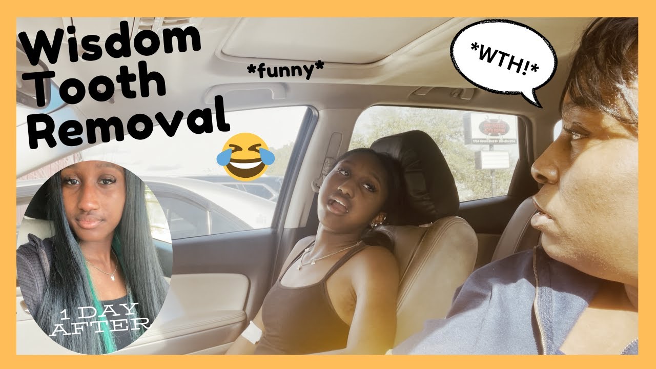 I Got My Wisdom Tooth Removed!! *VERY FUNNY* - YouTube