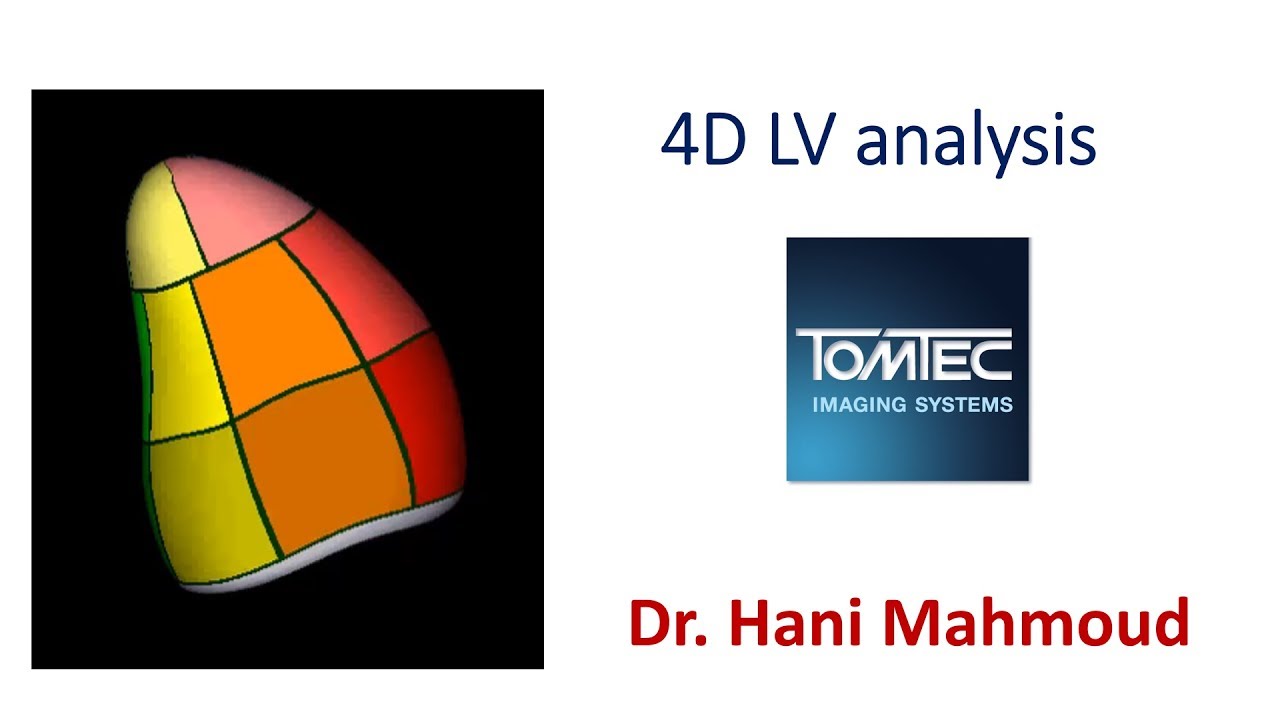 4D LV analysis using TomTec software - YouTube