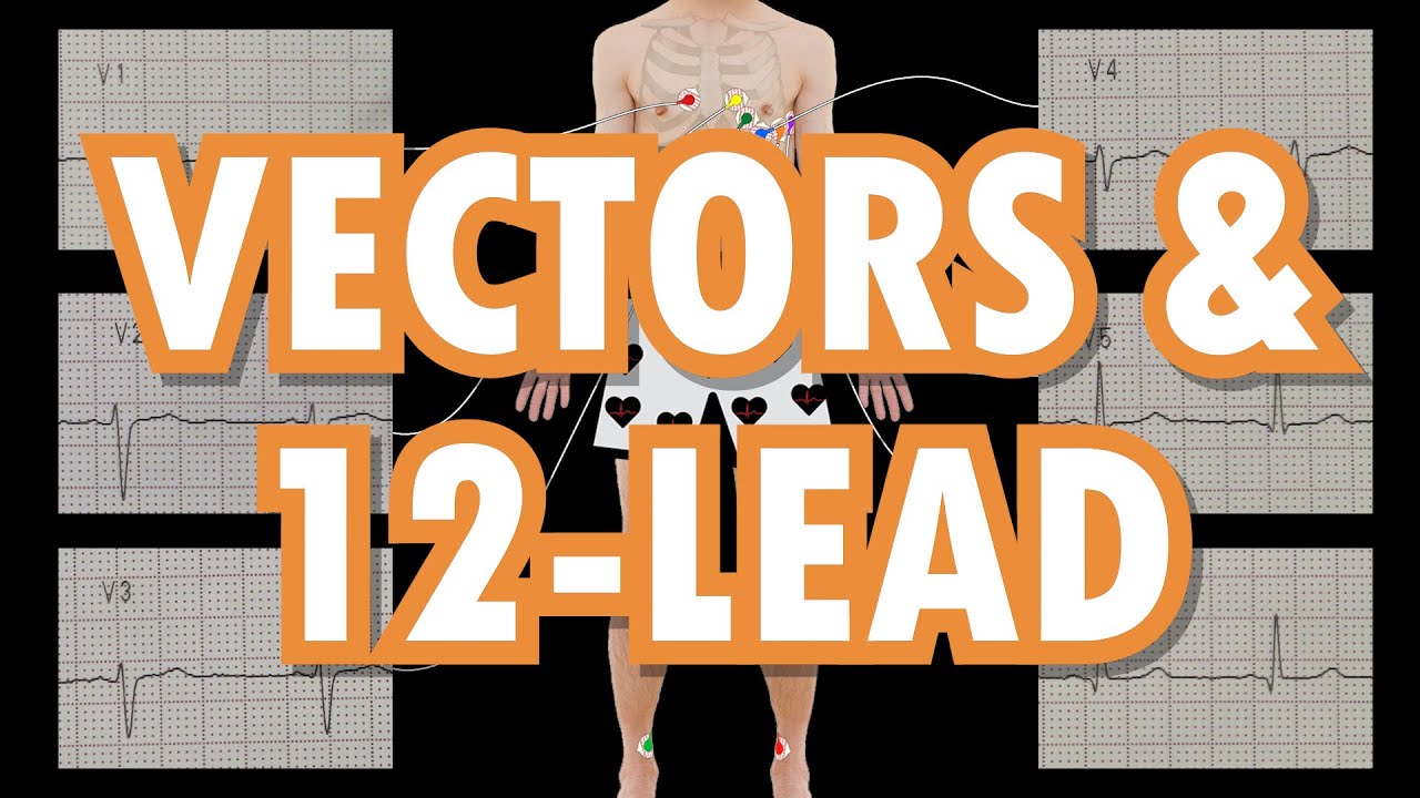 Easy EKG Part 3 (Vectors and 12-Lead) - YouTube