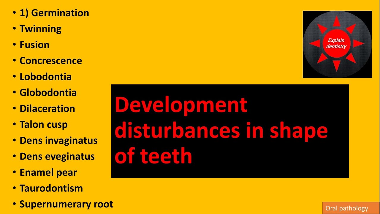 Development disturbances in shape of teeth // Dental anomalies ...