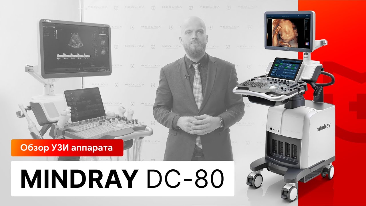 Обзор ультразвукового аппарата Mindray DC-80 - YouTube