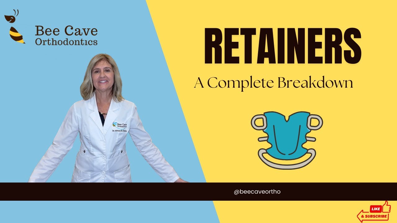 Reminders You MUST Know About Retainers - YouTube