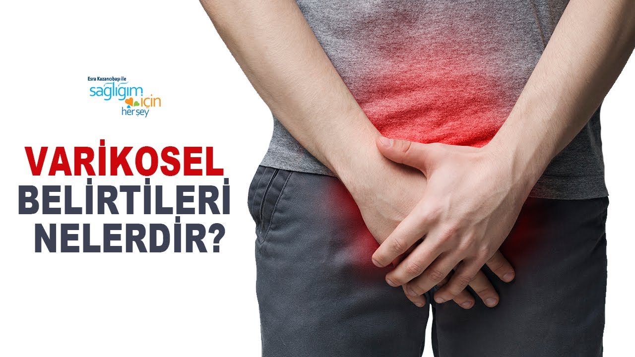 Varikosel Ağrısı Başka Hastalıklarla Karışabilir mi? - YouTube