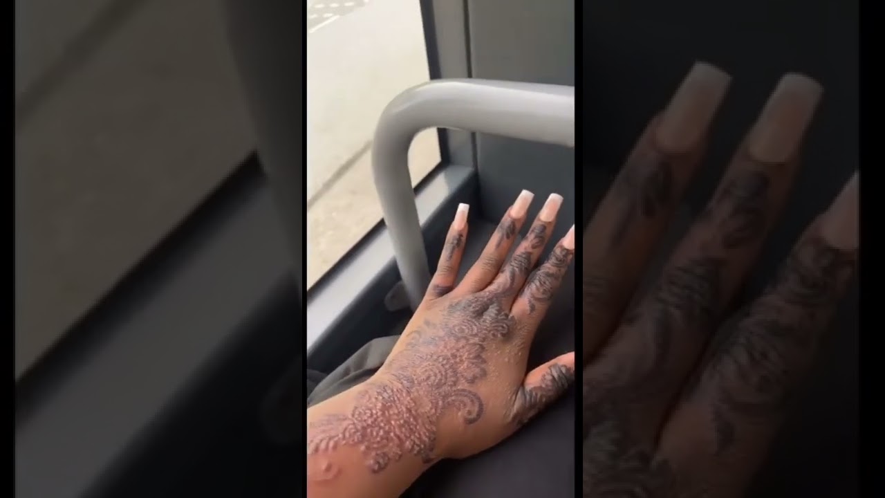 I'm Unable To Walk - Lady Opens Up On How She Had An Allergic Reaction ...