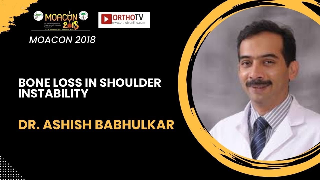 MOACON 2018 : BONE LOSS IN SHOULDER INSTABILITY - Dr. Ashish Babhulkar ...