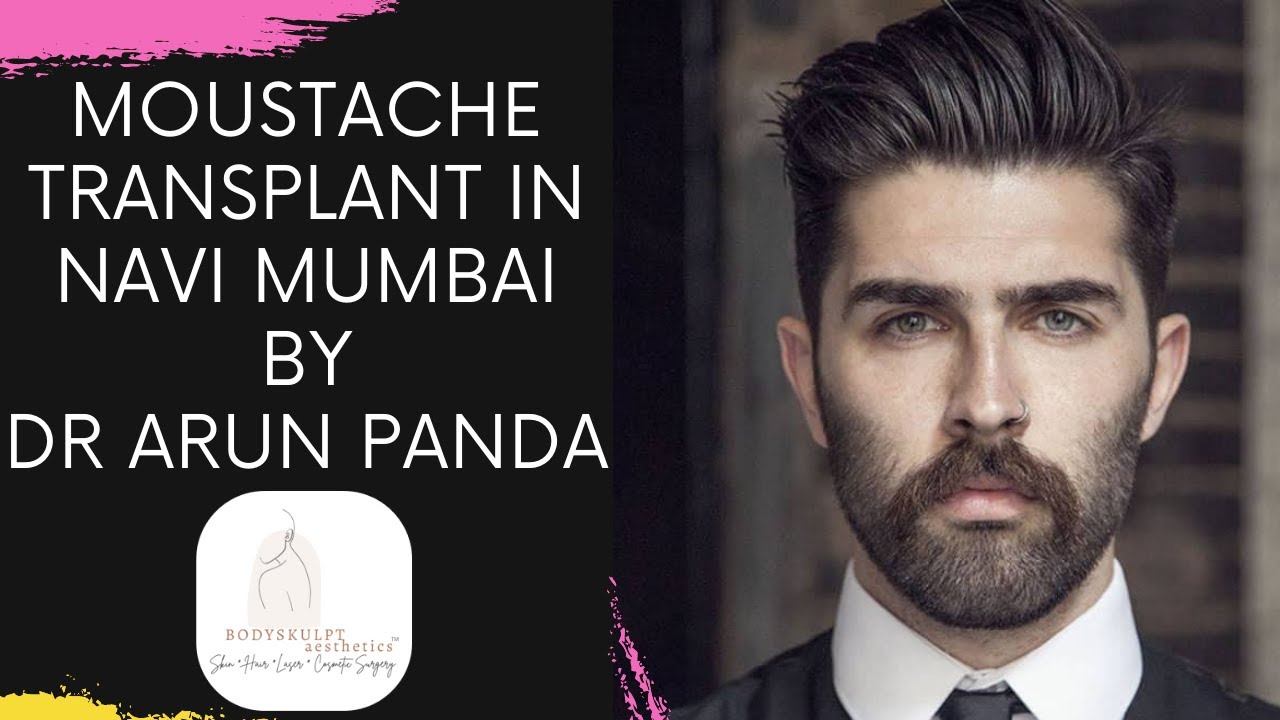 Moustache Transplant in Cleft Lip Patient in Navi Mumbai, India by Dr ...