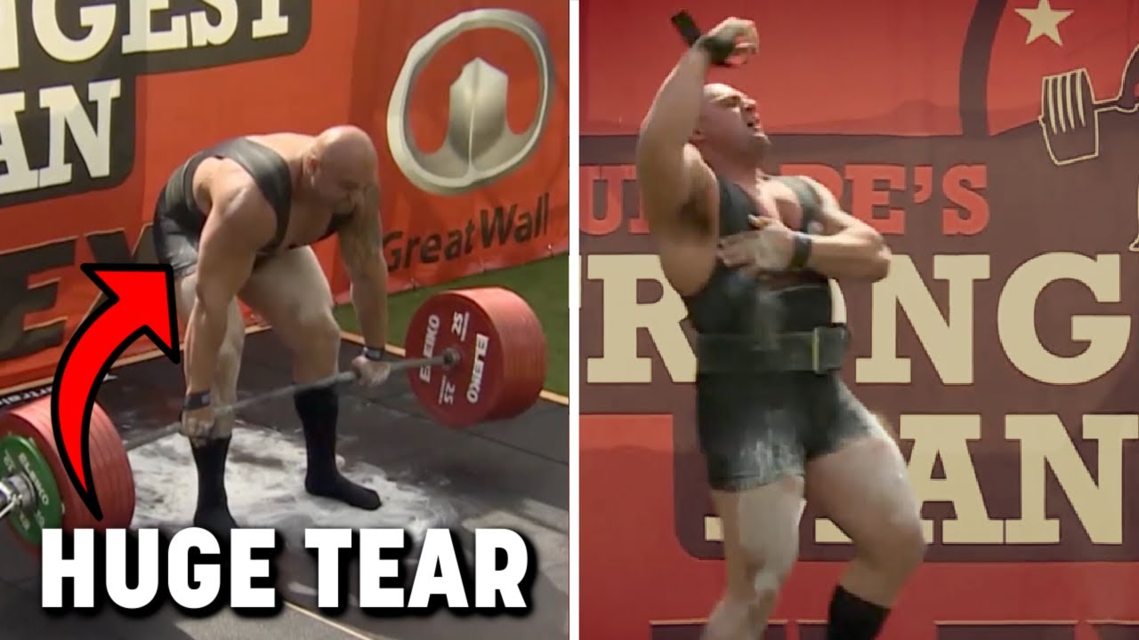 My Strongman Injuries Ranked Least to MOST Painful - YouTube