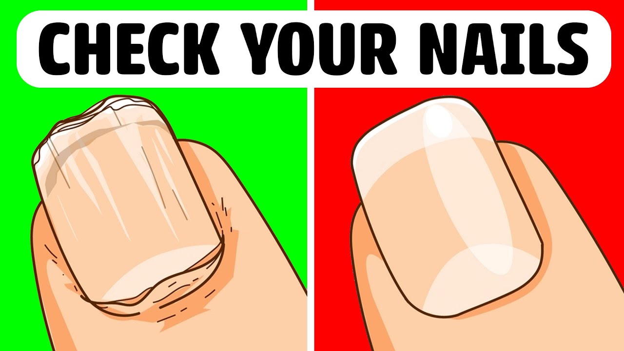 What Are Your Nails Saying About Your Health? - YouTube