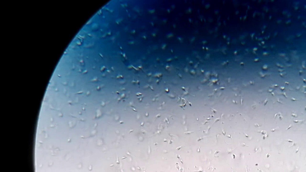 Seminal Fluid Analysis - YouTube