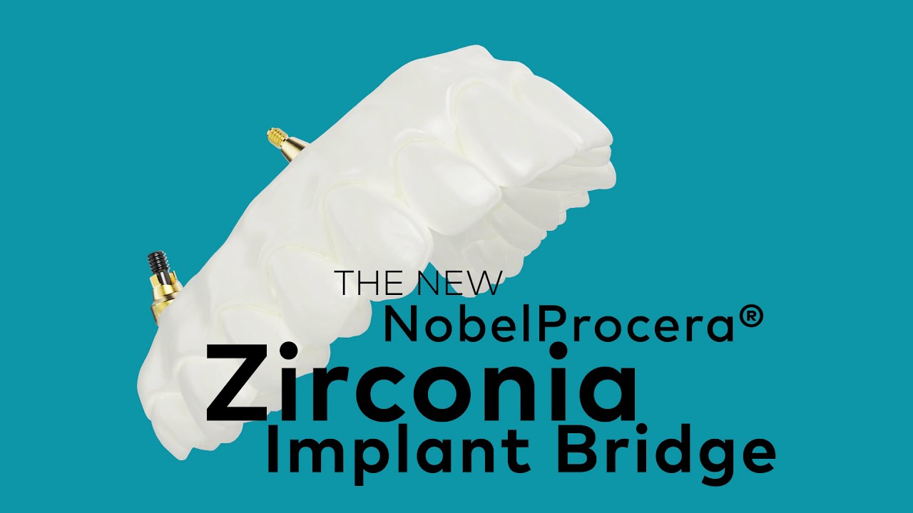 NobelProcera Zirconia Implant Bridge - YouTube