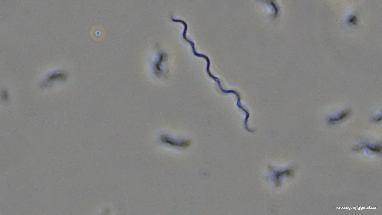 Bacterias con forma de espiral - spiral shape bacteria - YouTube