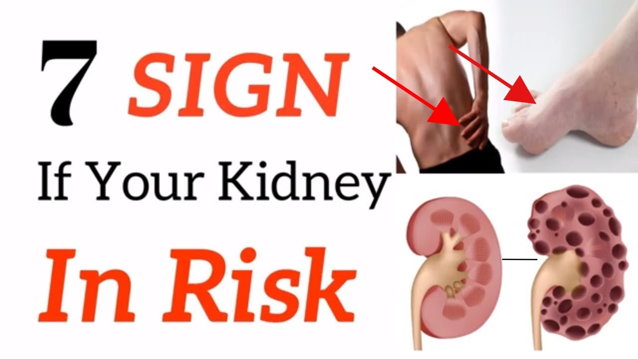 If Your Kidney Is In Danger, The Body Will Give You These 7 Signs - YouTube