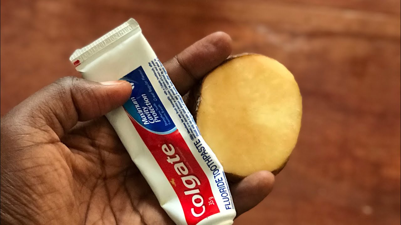 Ondoa madoa ,Chunusi ,kuungua na cream kwa siku 3 tu |remove dark spot ...
