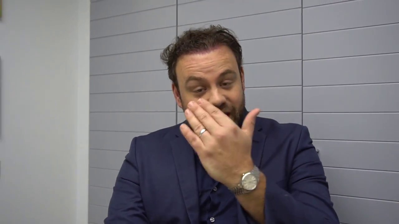 Ben Chambers DHI Lunch Hour Hair Transplant - YouTube