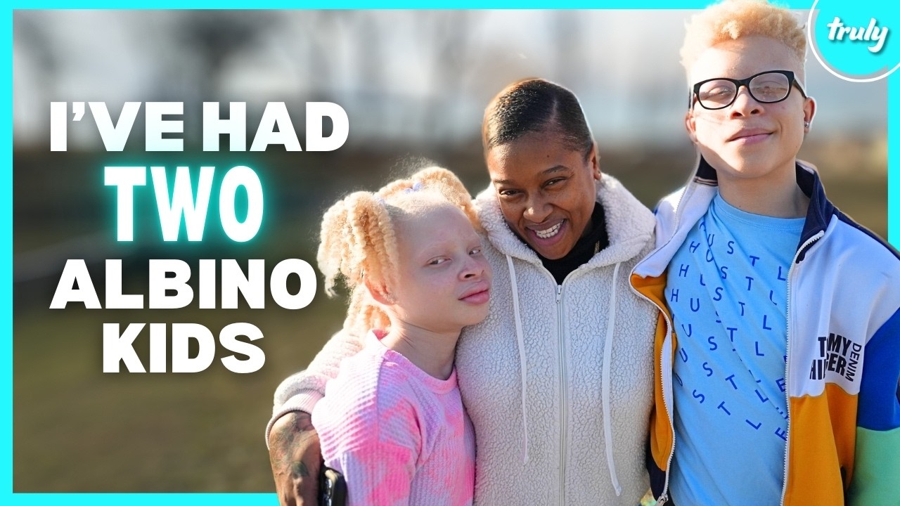I’m A Mom Of 2 Albino Children | BORN DIFFERENT - YouTube