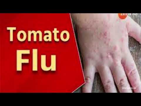 Know the signs of a new illness called tomato flu as there is now no treatment.