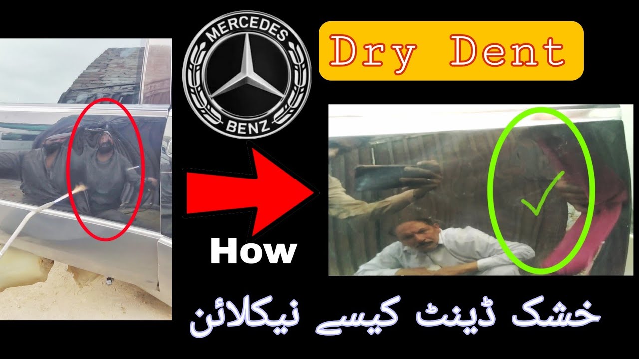 Dry Denting || Mercedes Benz || dry dent removal Dry Dent kese nikalain ( Lahore ) - YouTube